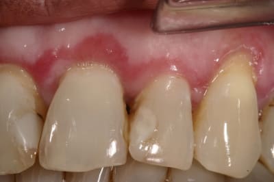 Img 7795 gcswqk - Eugenol