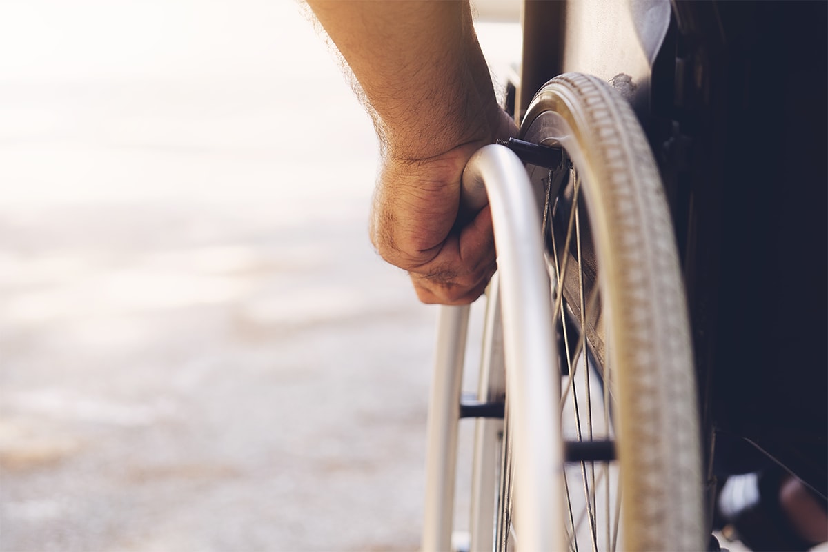 £500k CICA Award After Machete Attack and Amputation