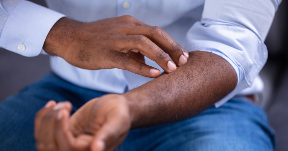 5 psoriasis treatments—and how to choose the right one for you - Sharecare