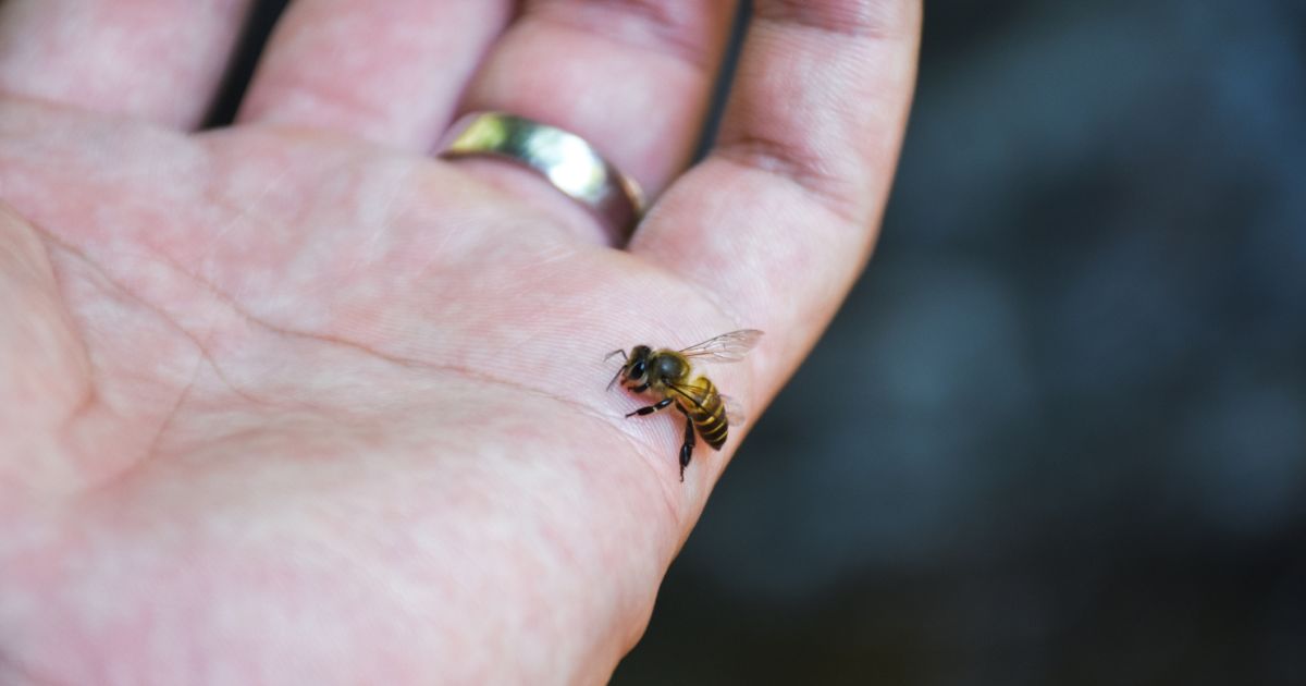 What you need to know about deadly allergic reactions - Sharecare